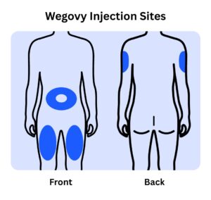 Wegovy Injection Sites: Where to Inject & How to Rotate Safely